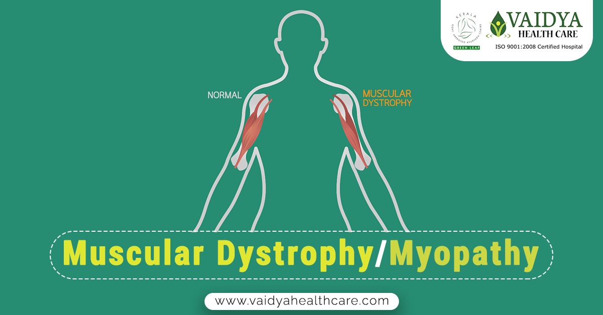 What is Muscular Dystrophy- Common Symptoms